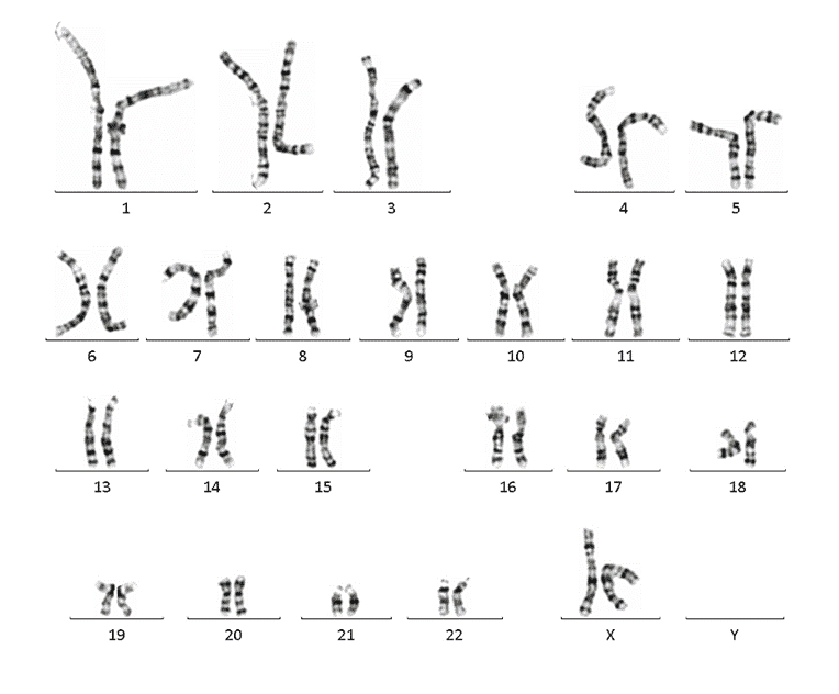 A Guide to an Egg Donor's Genetic Testing Summary (GTS) | Fairfax EggBank